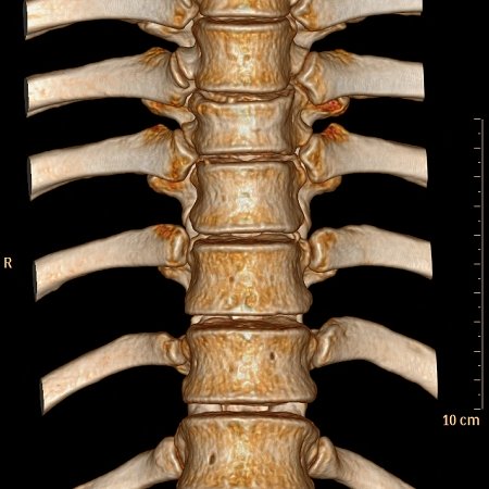CitiScan Radiology - Diagnostic Radiology - CitiScan Radiology Level 2 ...